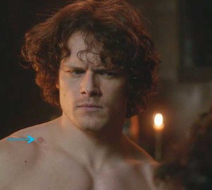 “To Arms, Too Arms, Two Arms!” – Outlander Anatomy