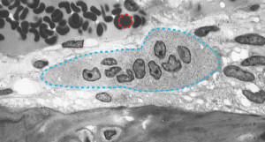 Anatomy Lesson #27: Colum’s Legs and Other Things, Too! – Outlander Anatomy