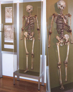 herophilus – Outlander Anatomy