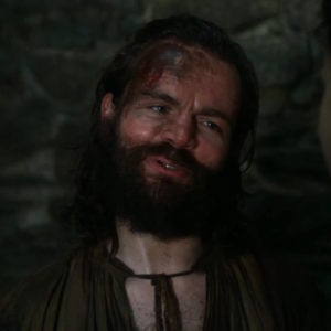 Anatomy Lesson #41: The Sad Demise of Angus Mhor – Outlander Anatomy
