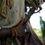 Anatomy Lesson #65: Anatomy of a Hanging – Outlander Anatomy