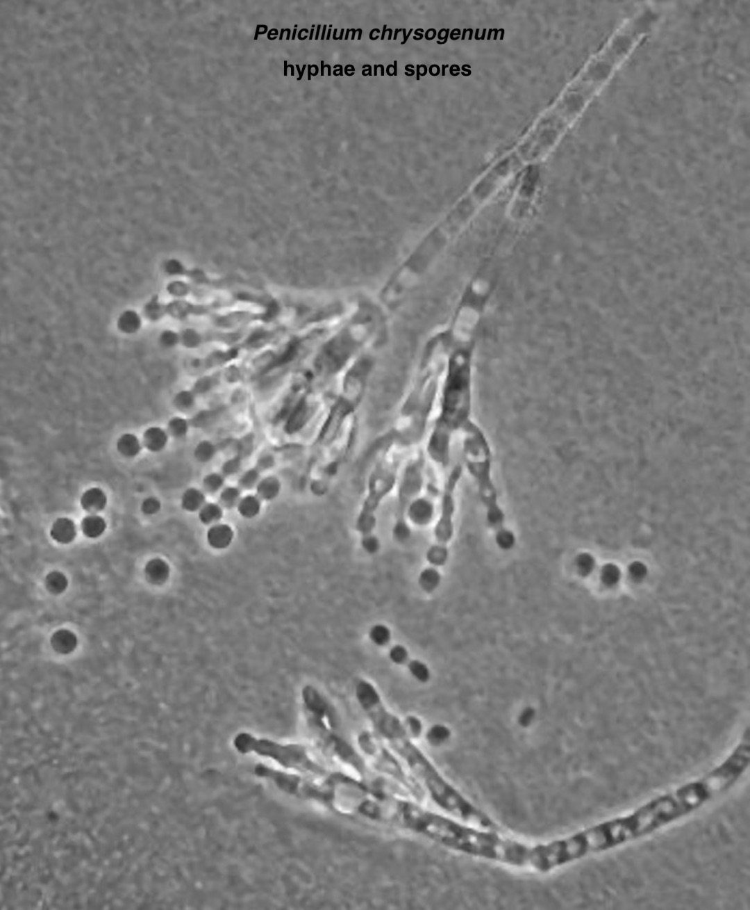 Penicillium – Outlander Anatomy